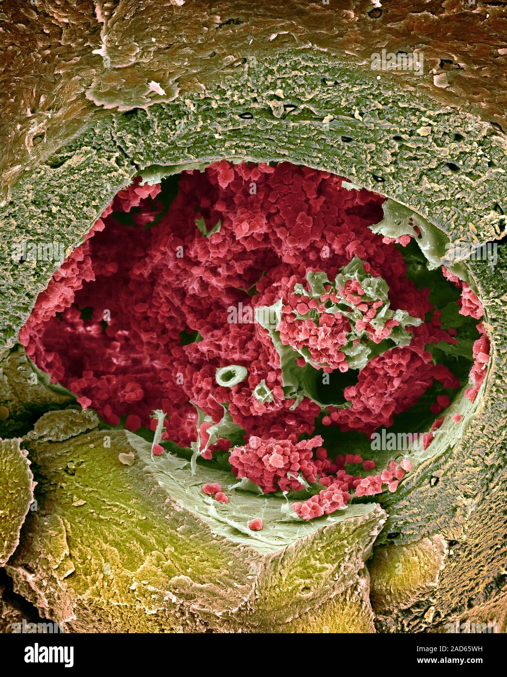 Compact bone and bone marrow cavity (lacuna), coloured scanning ...