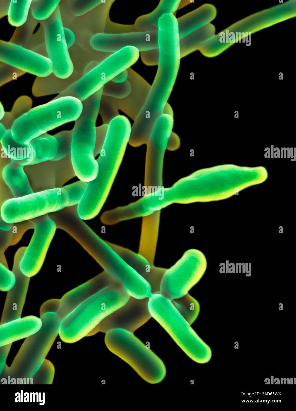 Coloured scanning electron micrograph (SEM) of Listeria monocytogenes ...