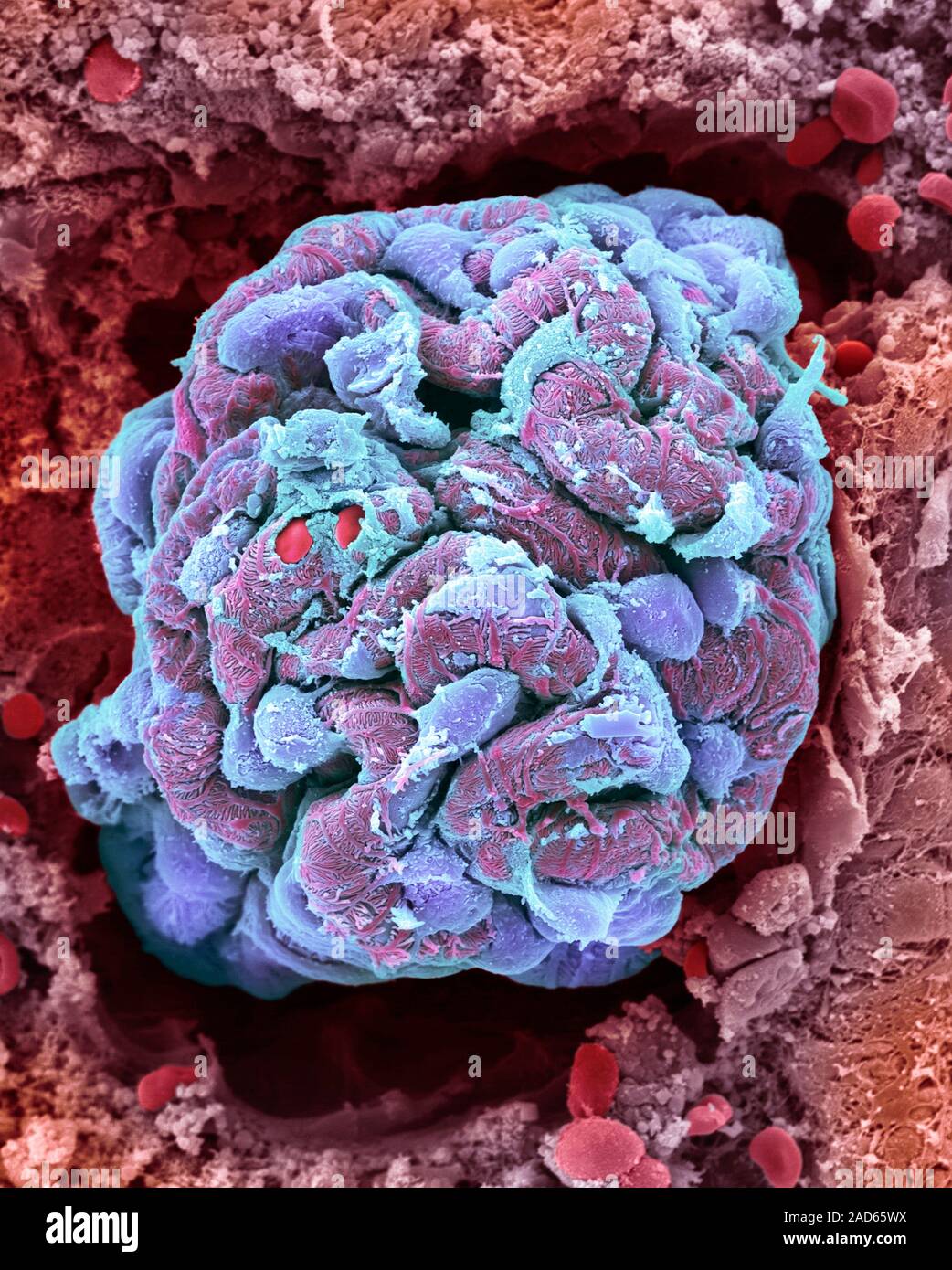 Kidney glomerulus (podocytes and capillaries of the renal corpuscle ...