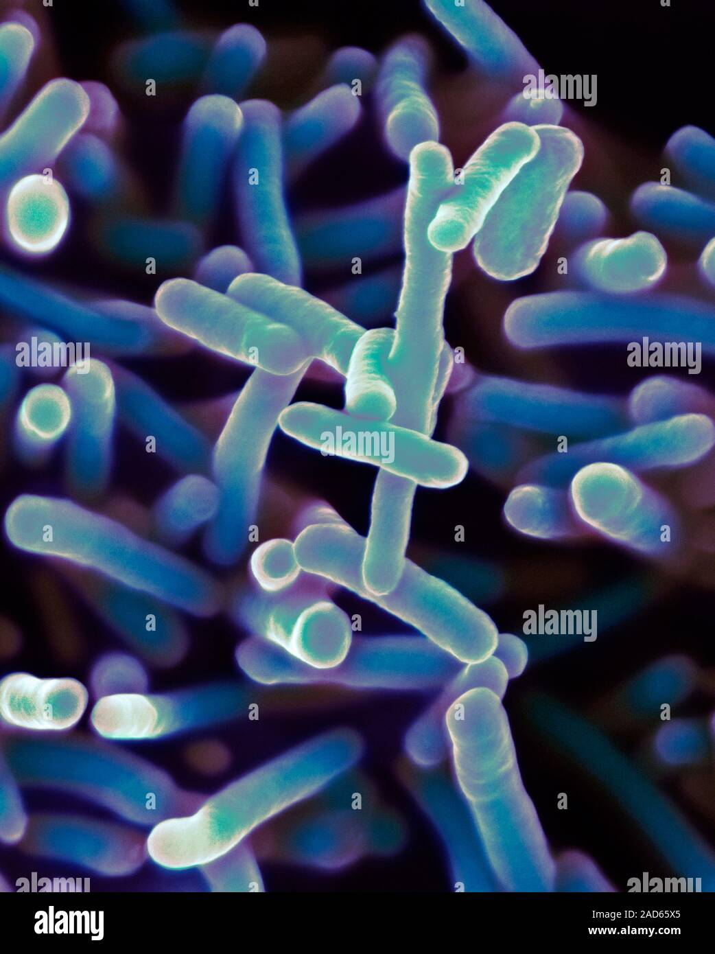 Shigella dysenteriae bacteria, coloured scanning electron micrograph ...