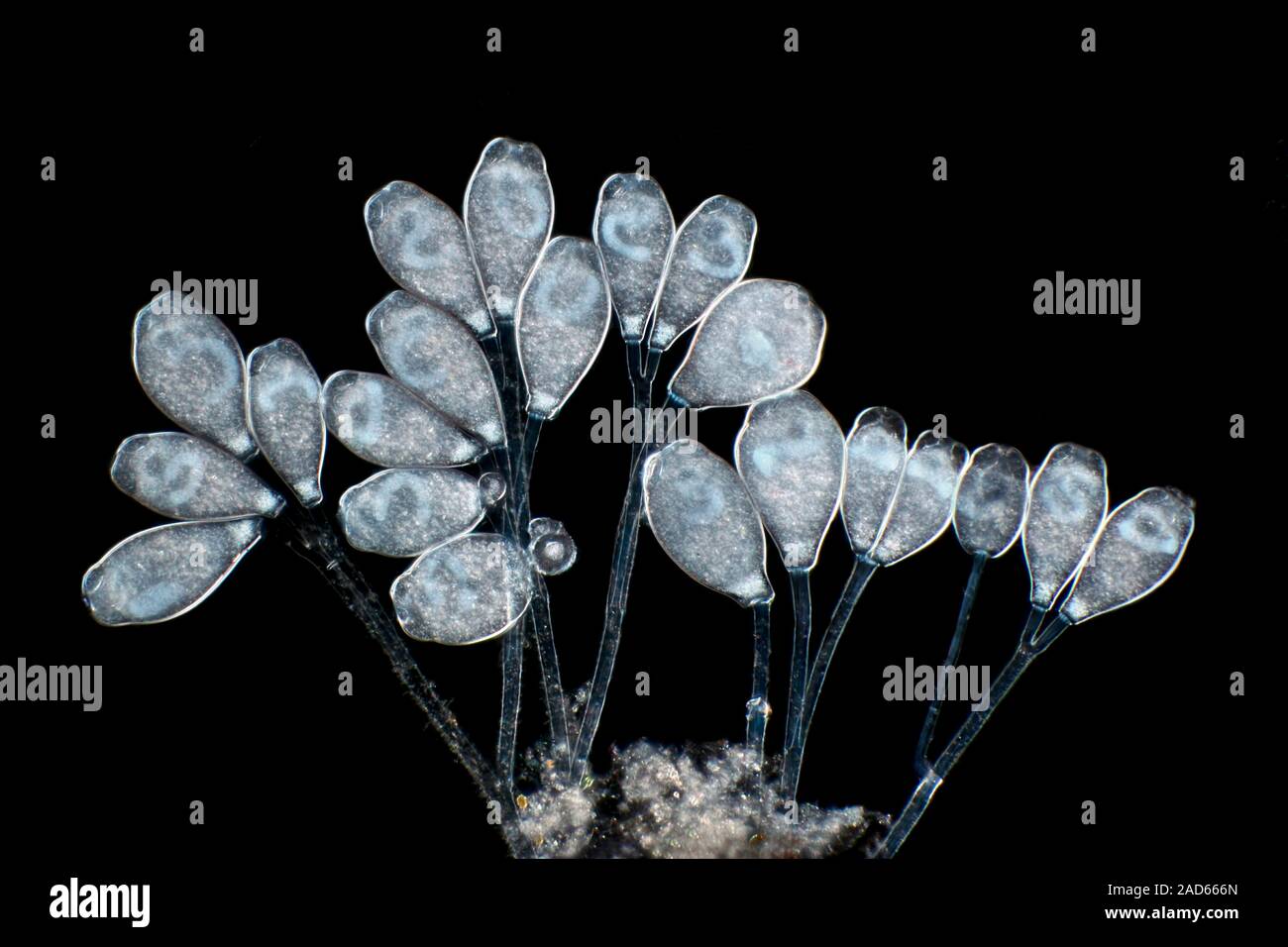 Vorticella protozoa. Darkfield illuminated light micrograph of a colony ...