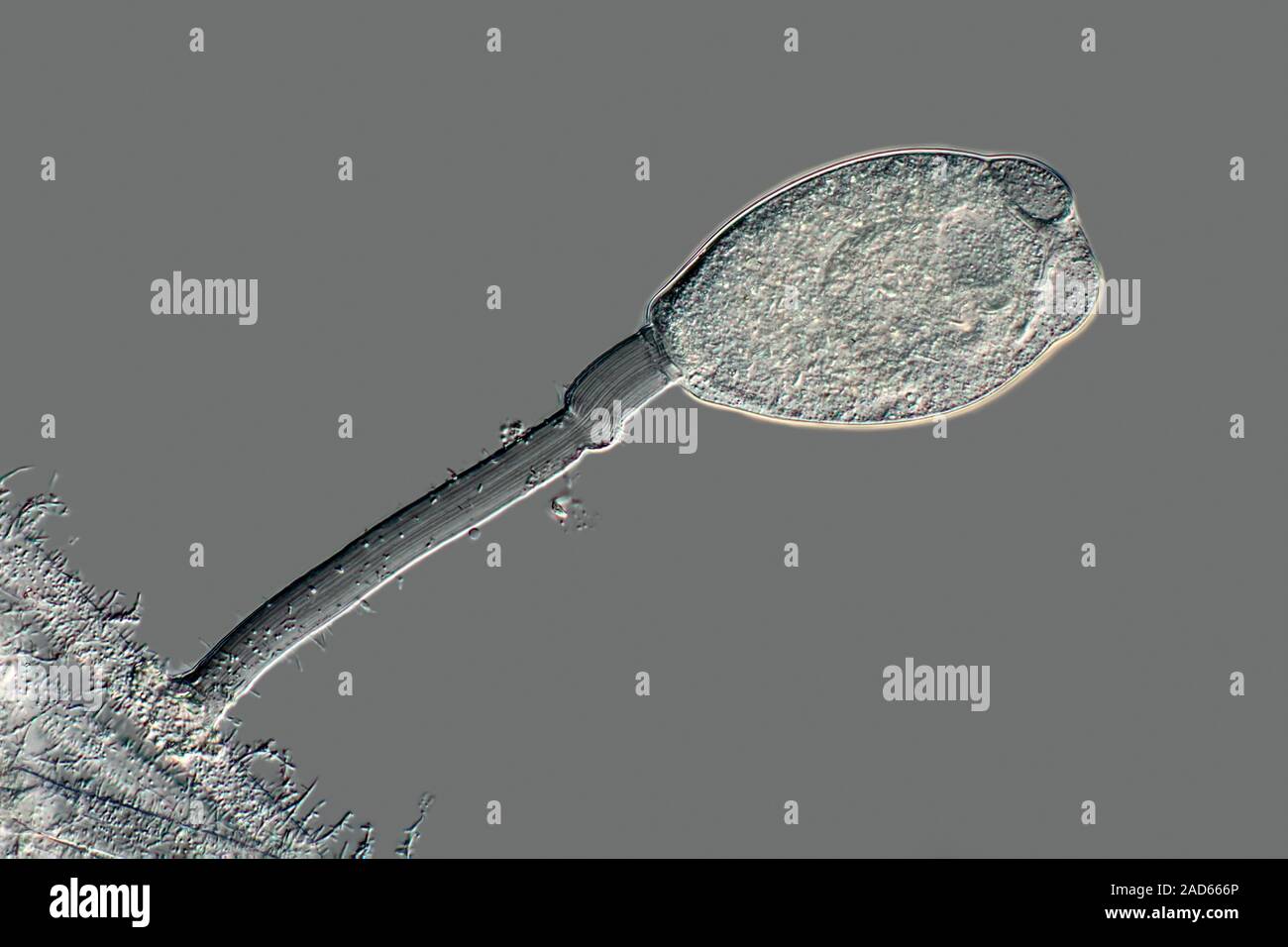 Vorticella protozoa. Differential interference contrast (DIC) light ... Vorticella protozoa. Differential interference contrast (DIC) light ...