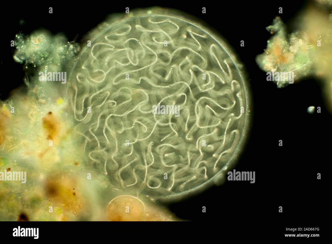 Nostoc cyanobacteria. Darkfield illuminated light micrograph of a ...