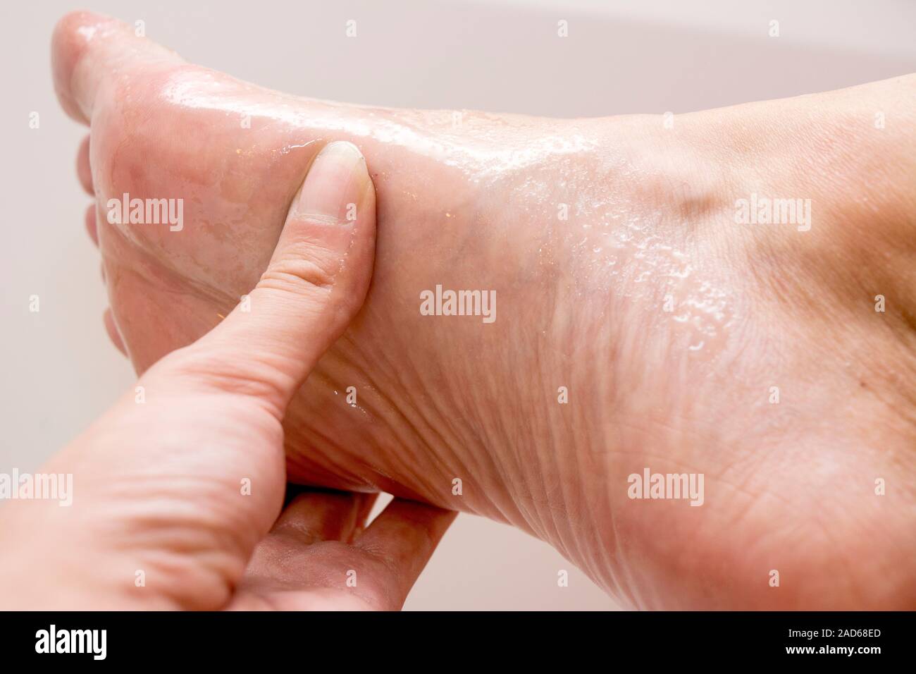 Dead tissue hi-res stock photography and images - Alamy