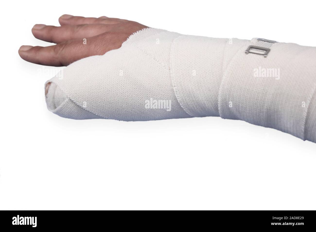 Overstretching hi-res stock photography and images - Alamy