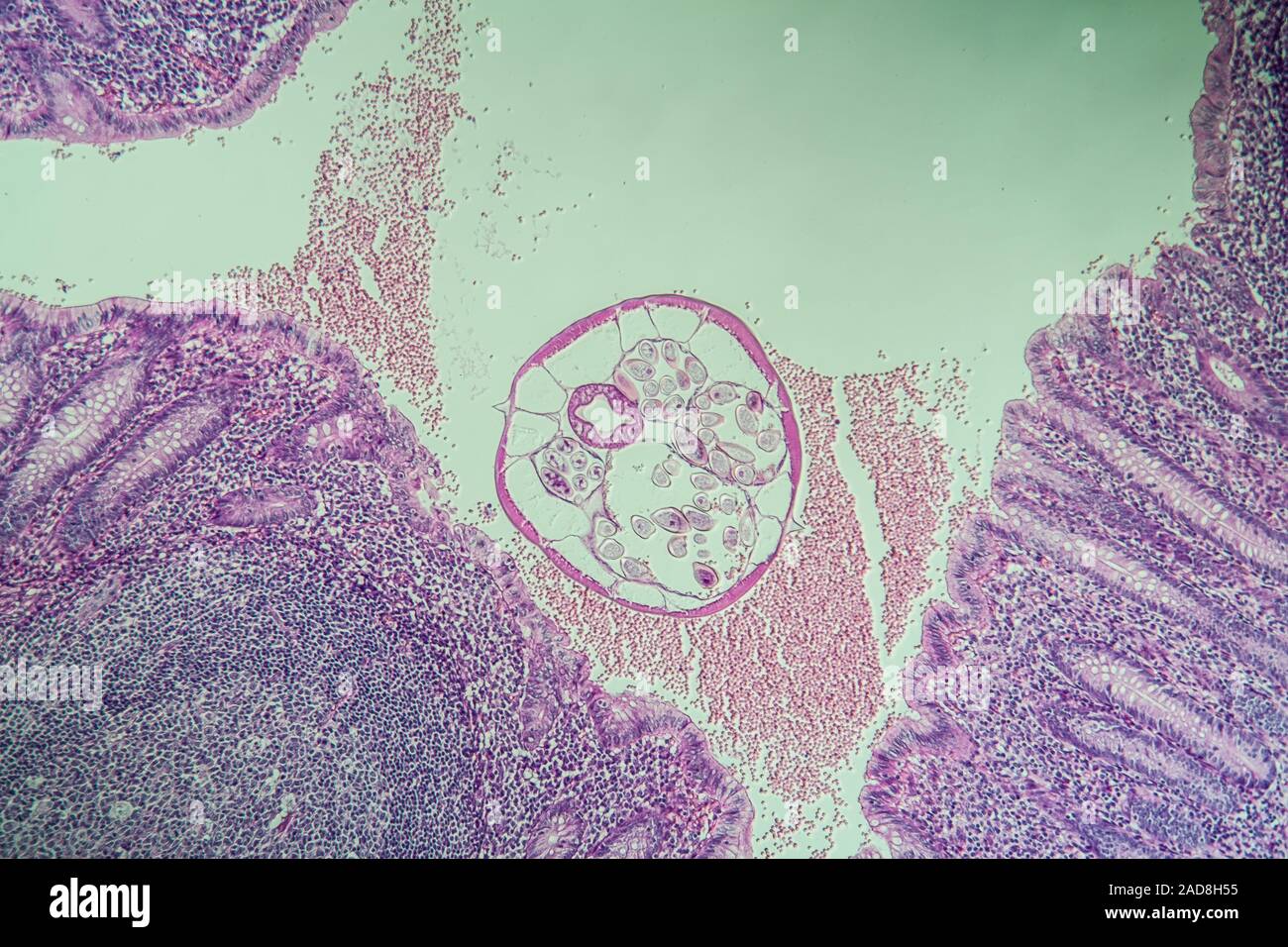 Cecum hi-res stock photography and images - Alamy