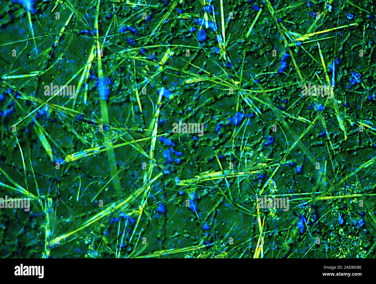 Mushrooms and bacteria destroy emulsion film under the microscope 200x ...