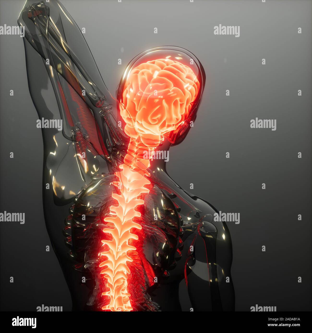 Human Brain Radiology Exam Stock Photo - Alamy