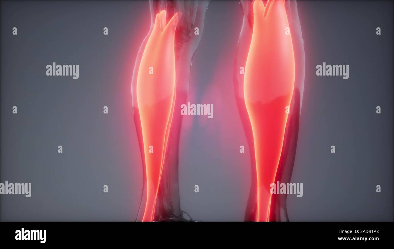gastrocnemius- Visible muscle anatomy map Stock Photo - Alamy