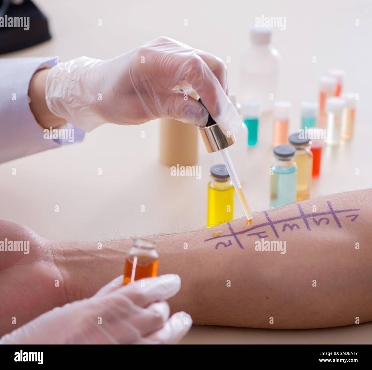 Doctor testing allergy reaction of patient in hospital Stock Photo - Alamy