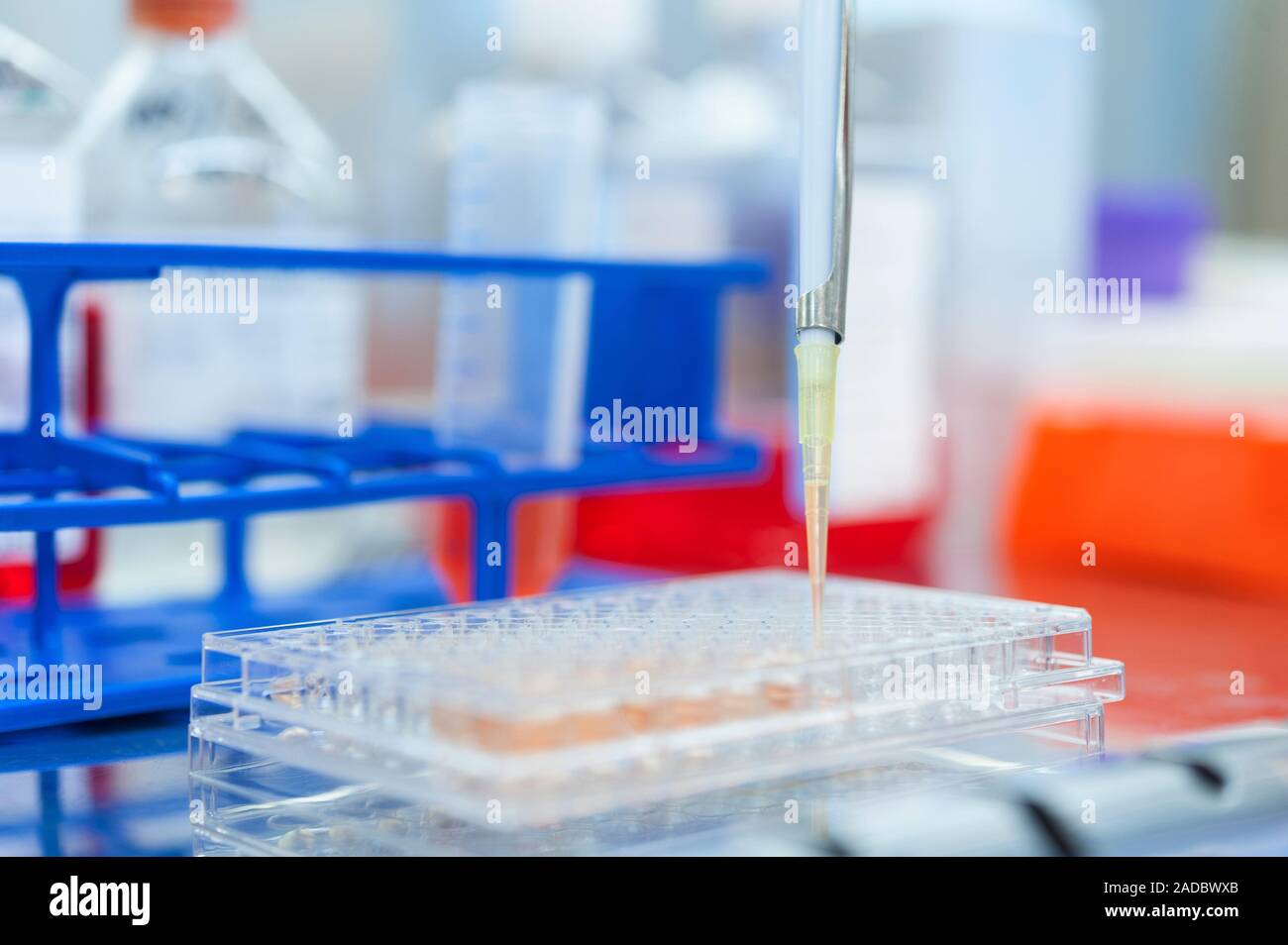 Pipetting blood samples. Pipette being used to process blood samples ...
