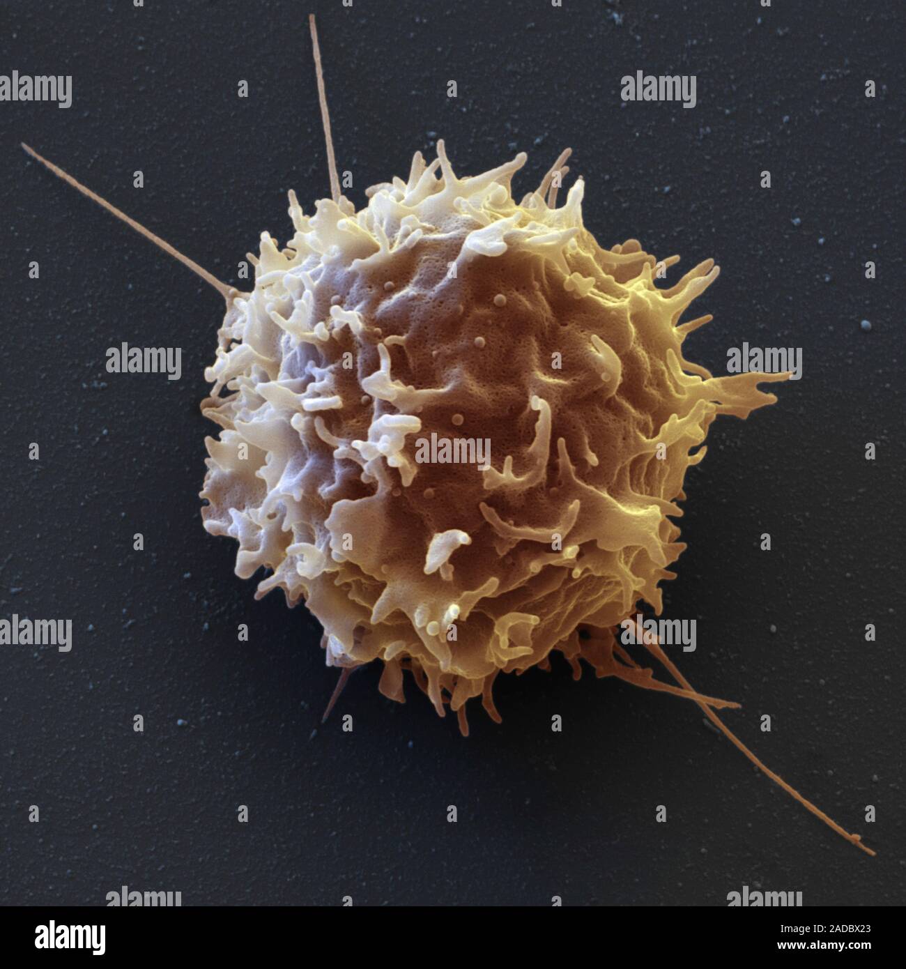 Coloured scanning electron micrograph (SEM) of a natural killer (NK ...