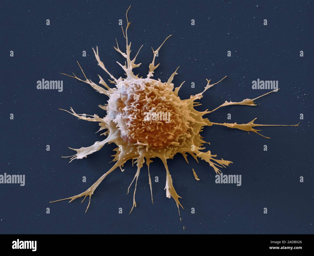 Coloured scanning electron micrograph (SEM) of a natural killer (NK ...
