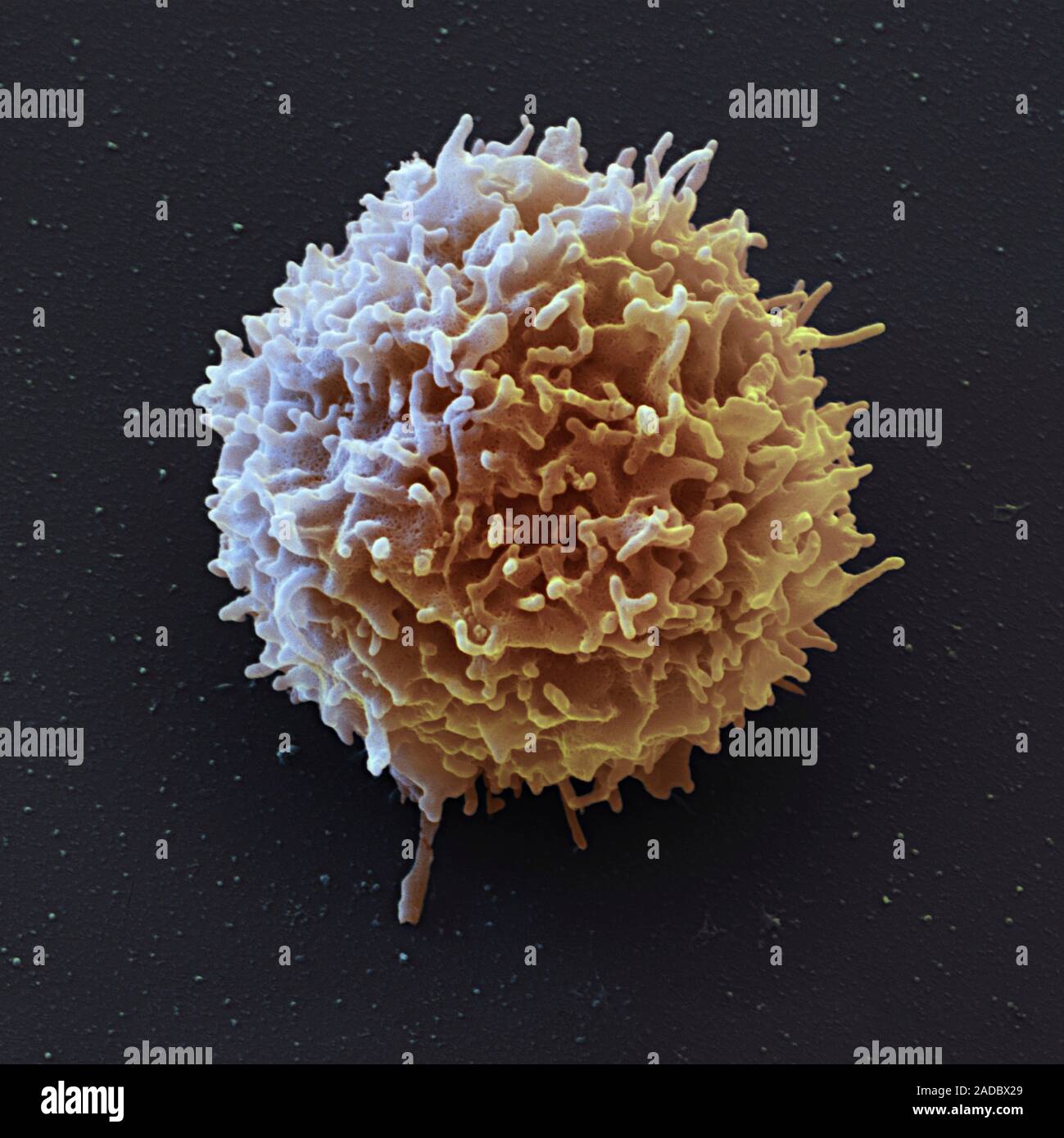 Coloured scanning electron micrograph (SEM) of a natural killer (NK ...