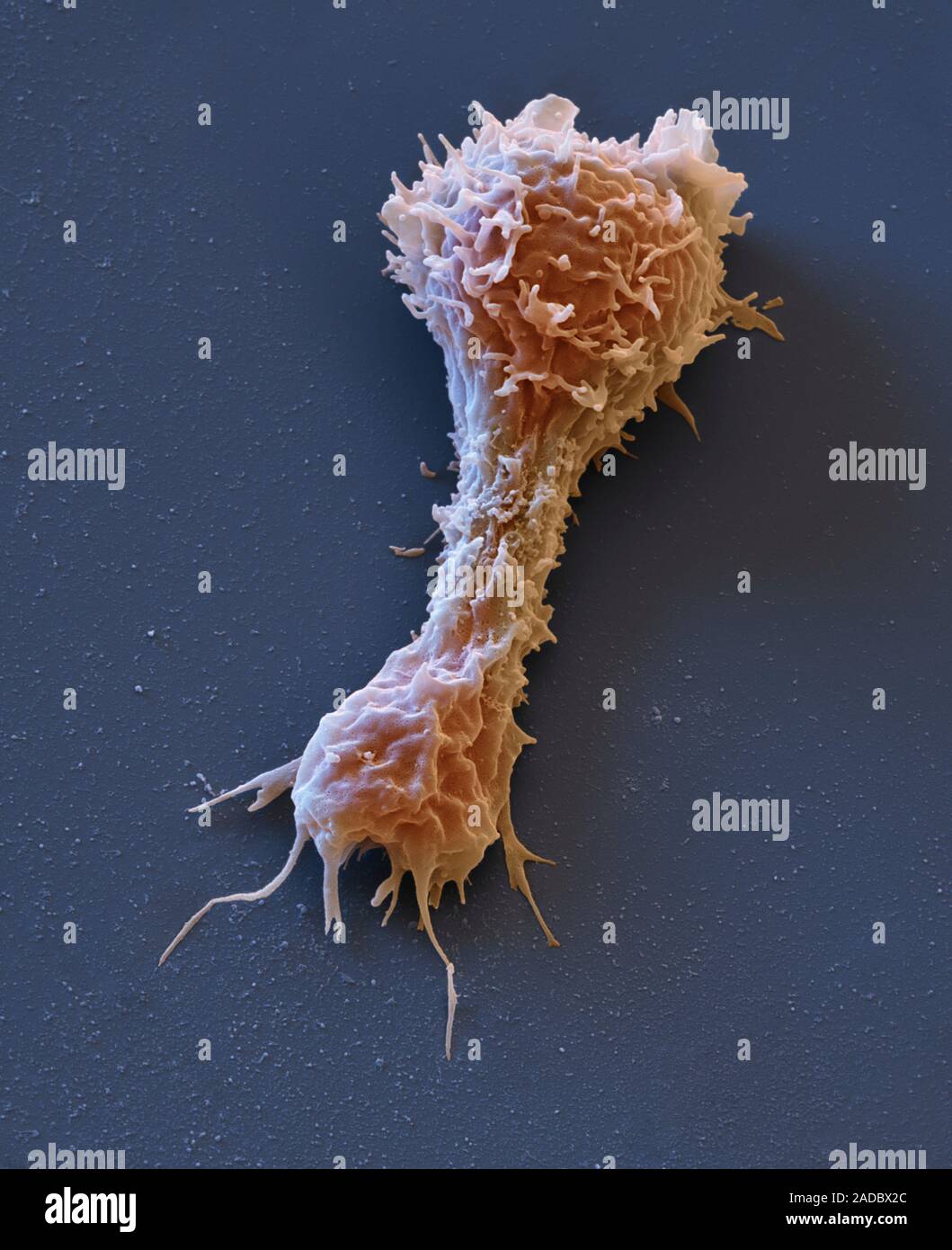 Coloured scanning electron micrograph (SEM) of a natural killer (NK ...