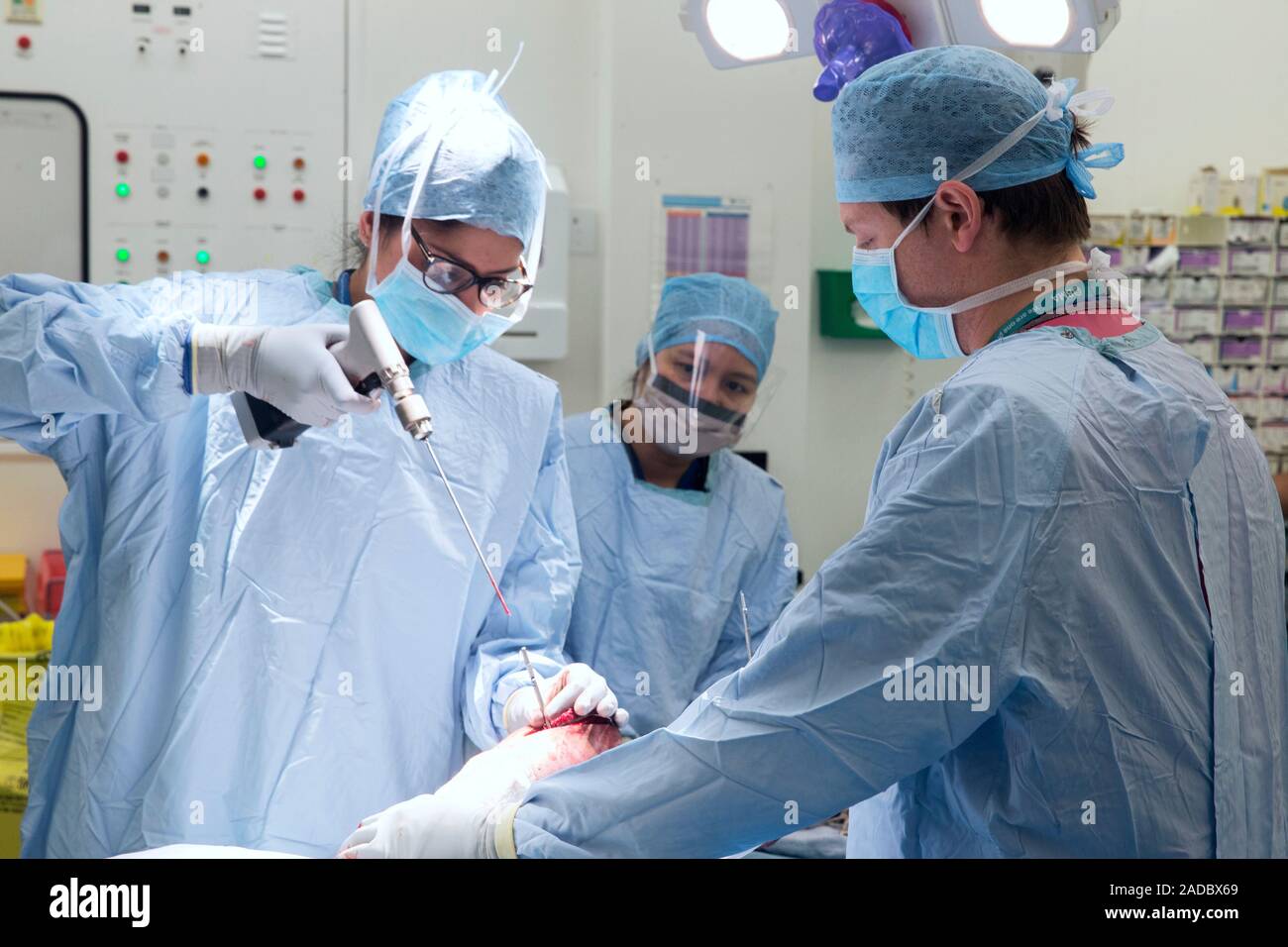 Hip replacement surgery. Surgeons performing hip replacement surgery ...
