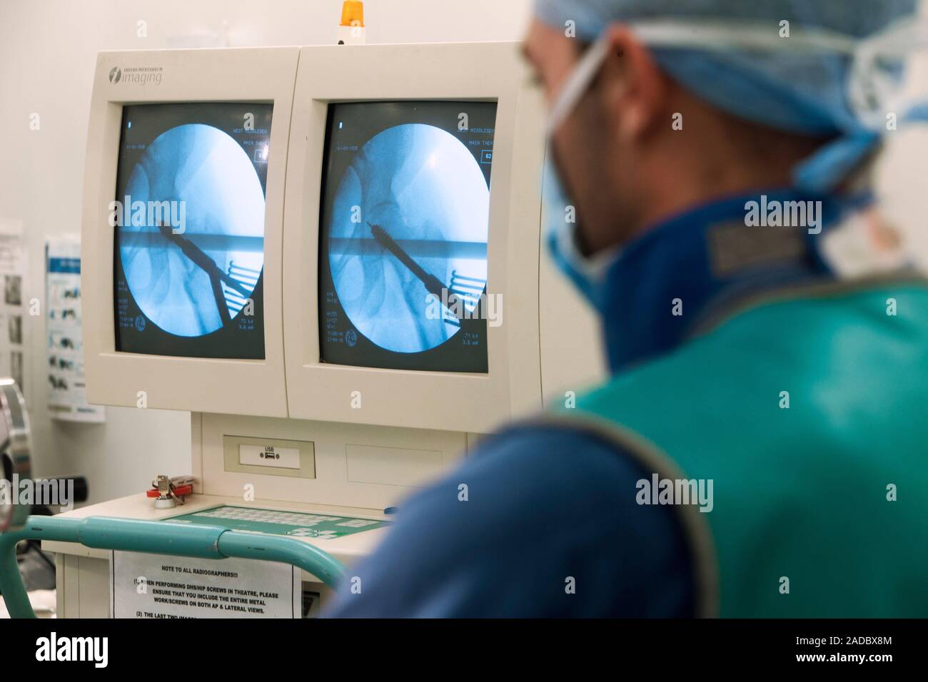X-ray technician at work. Technician reviewing a patient's X-rays ...
