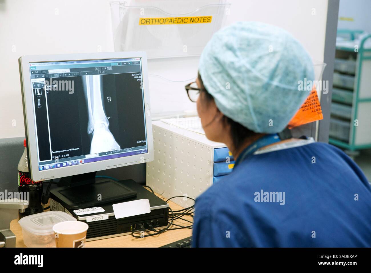 Surgeon checking X-rays. Surgeon reviewing a patient's X-rays onscreen ...