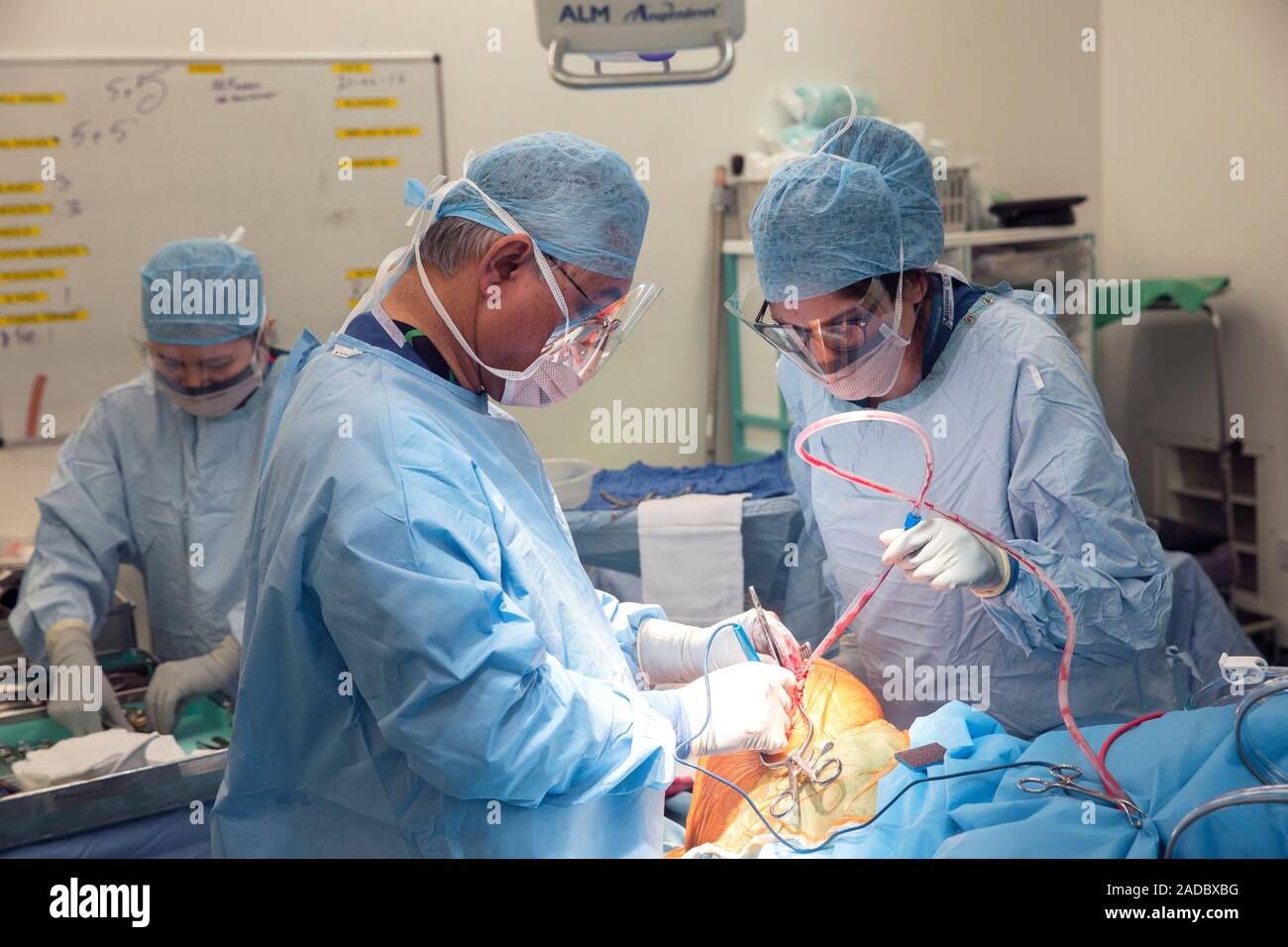Hip replacement surgery. Surgeons performing hip replacement surgery ...