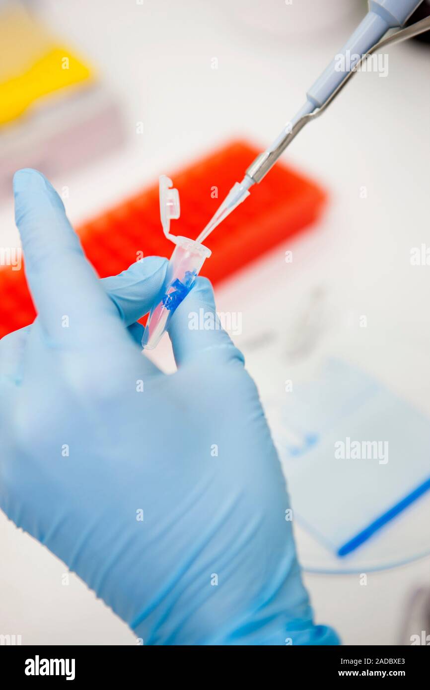 Protein analysis and sample preparation. Researcher pipetting a liquid ...