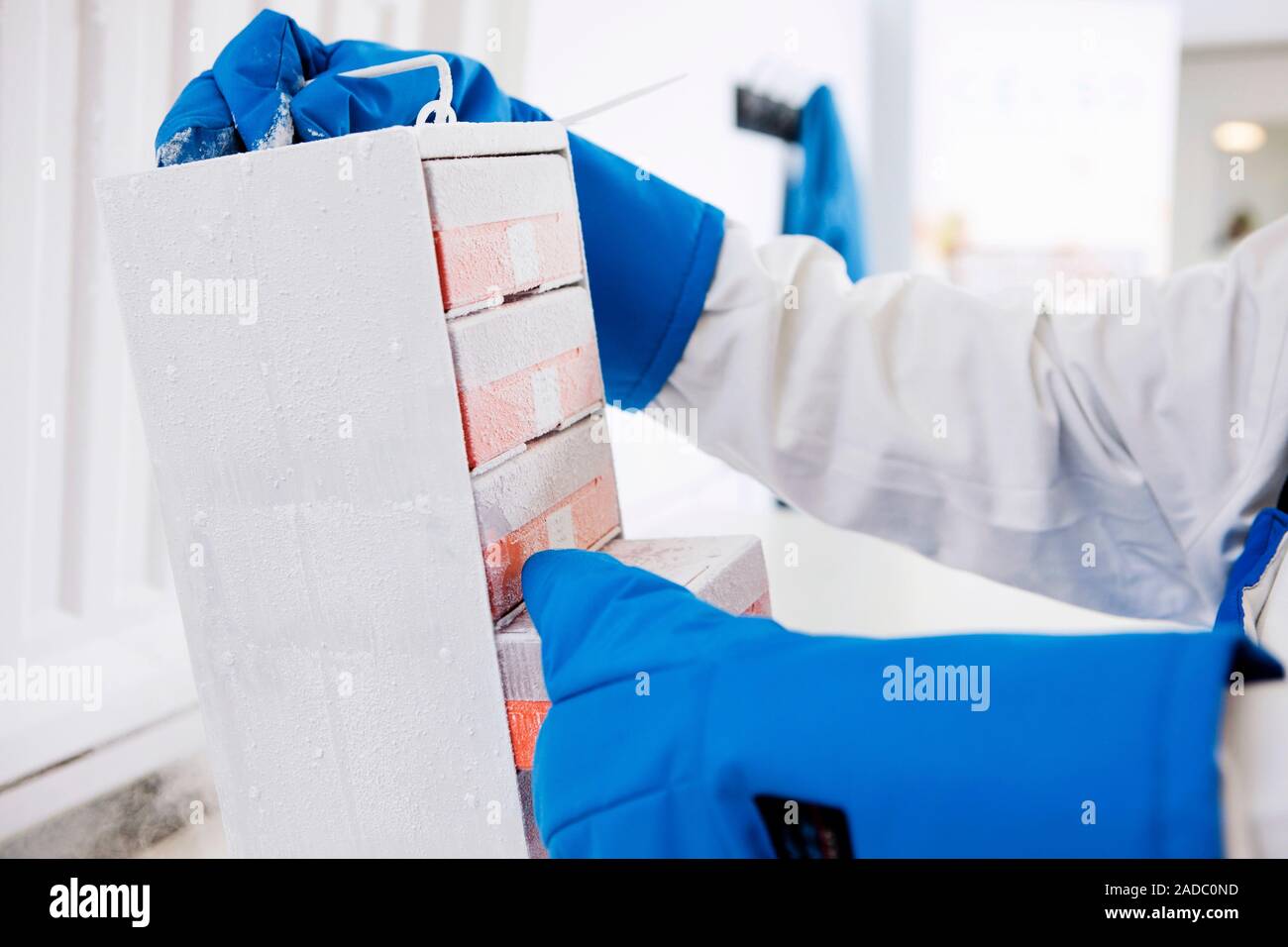 Cryopreservation in stem cell research. Researcher handling stem cell ...