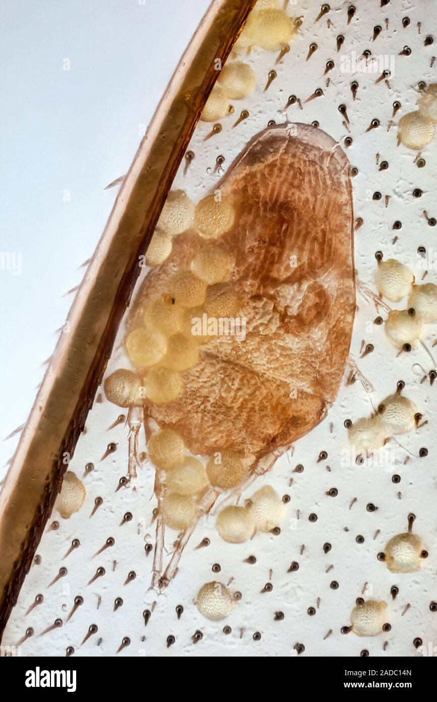 Close-up of a parasitic mite on a bee wing, along with some pollen ...