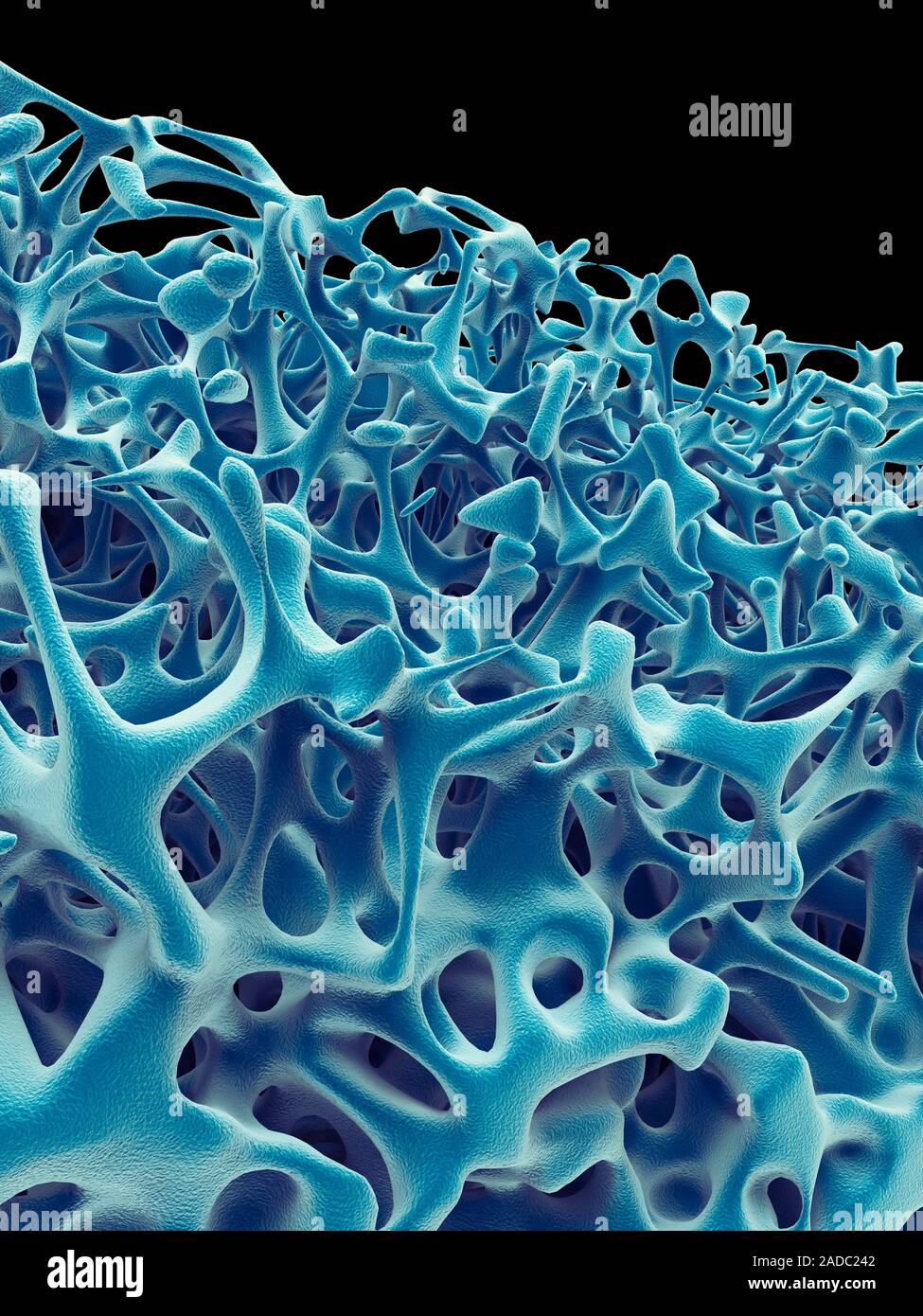 Bone tissue. Computer artwork of cancellous (spongy) bone. Bone tissue ...