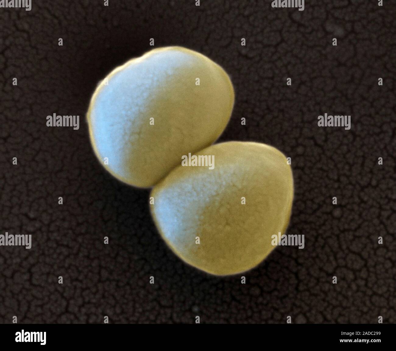 Staphylococcus lugdunensis bacteria, coloured scanning electron ...