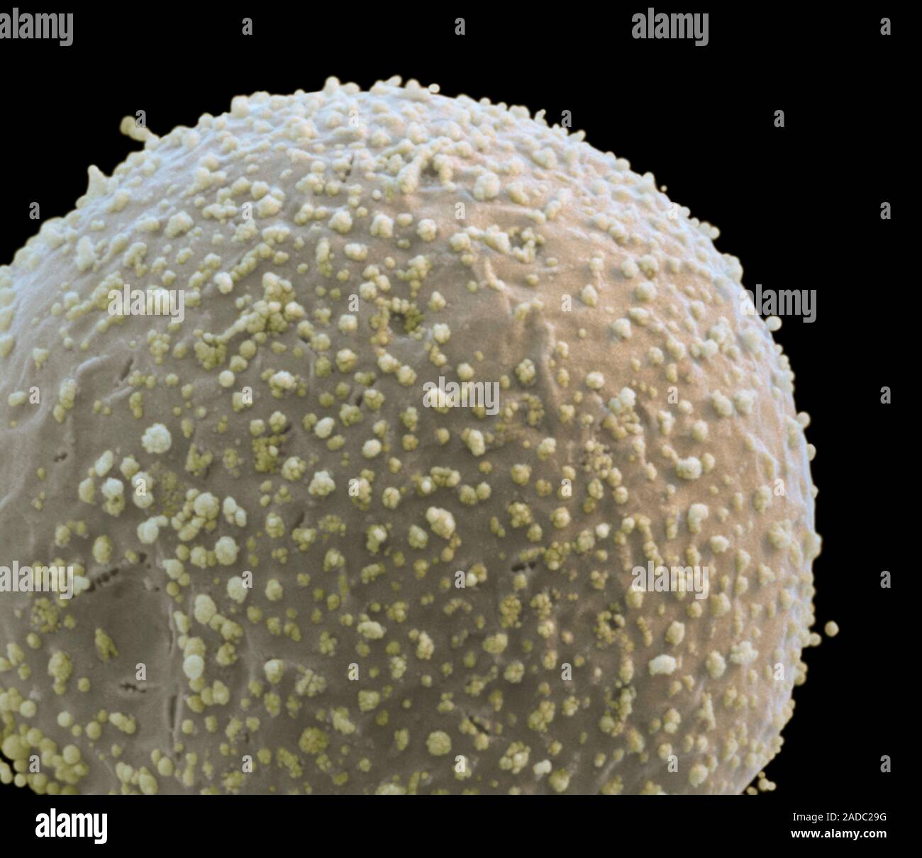 Milk fat droplet, coloured scanning electron micrograph (SEM). The ...