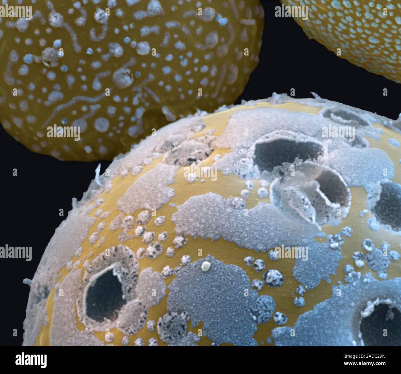 Milk fat droplets, coloured scanning electron micrograph (SEM). The ...