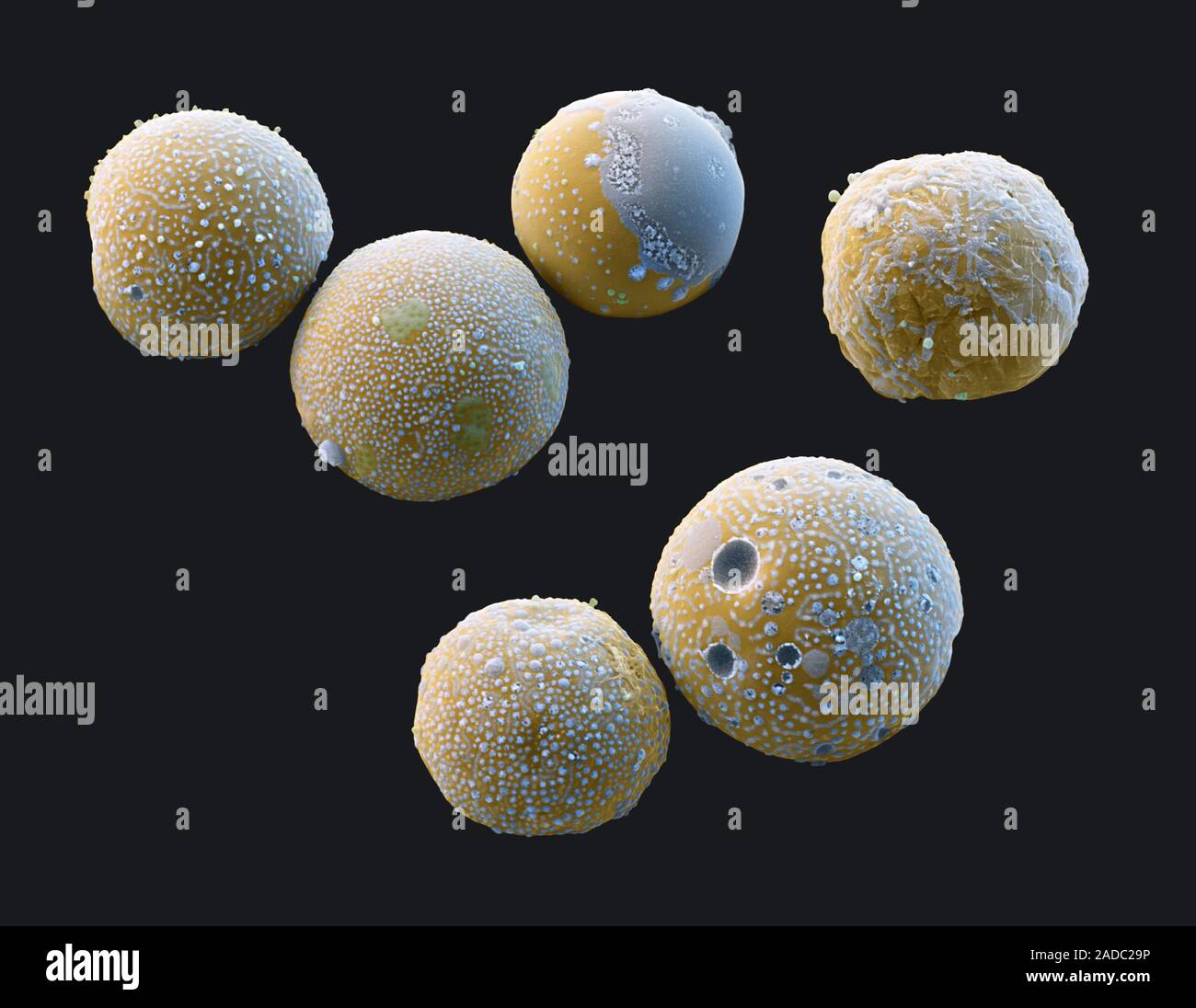 Milk fat droplets, coloured scanning electron micrograph (SEM). The ...