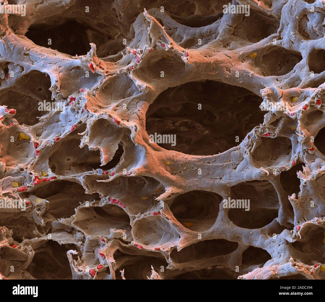 Lung alveoli. Coloured scanning electron micrograph (SEM) of a freeze ...