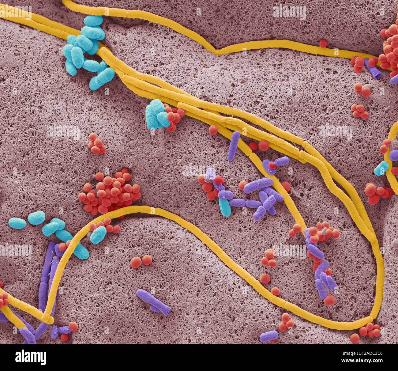 Coloured scanning electron micrograph (SEM) of bacteria cultured from a ...