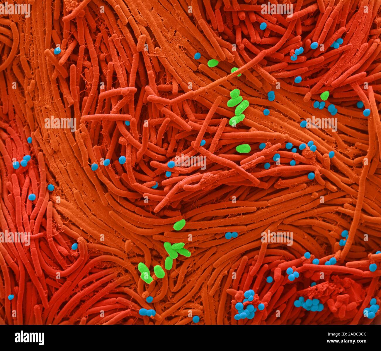 Nasal bacterial culture. Coloured scanning electron micrograph (SEM) of ...