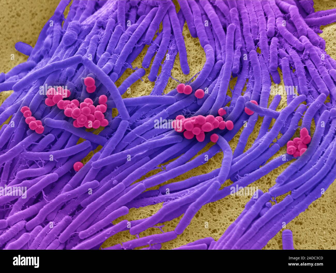 Coloured scanning electron micrograph (SEM) of bacteria cultured from a ...