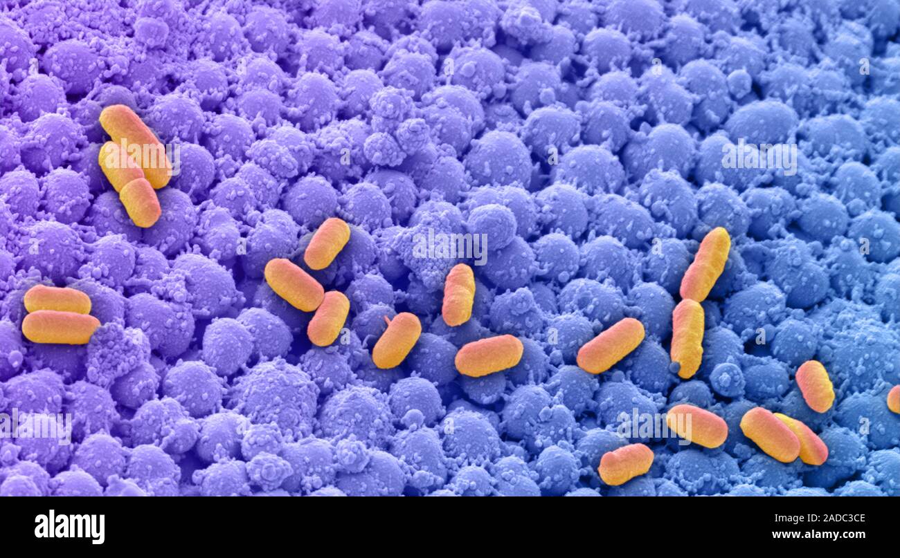 Nasal bacterial culture. Coloured scanning electron micrograph (SEM) of ...