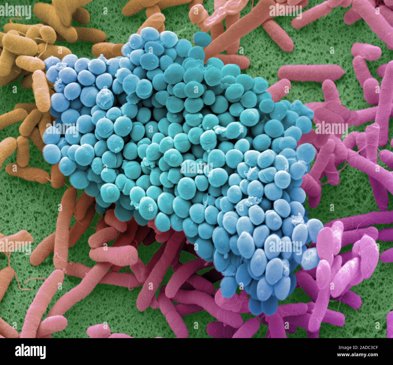 Coloured scanning electron micrograph (SEM) of bacteria cultured from a ...