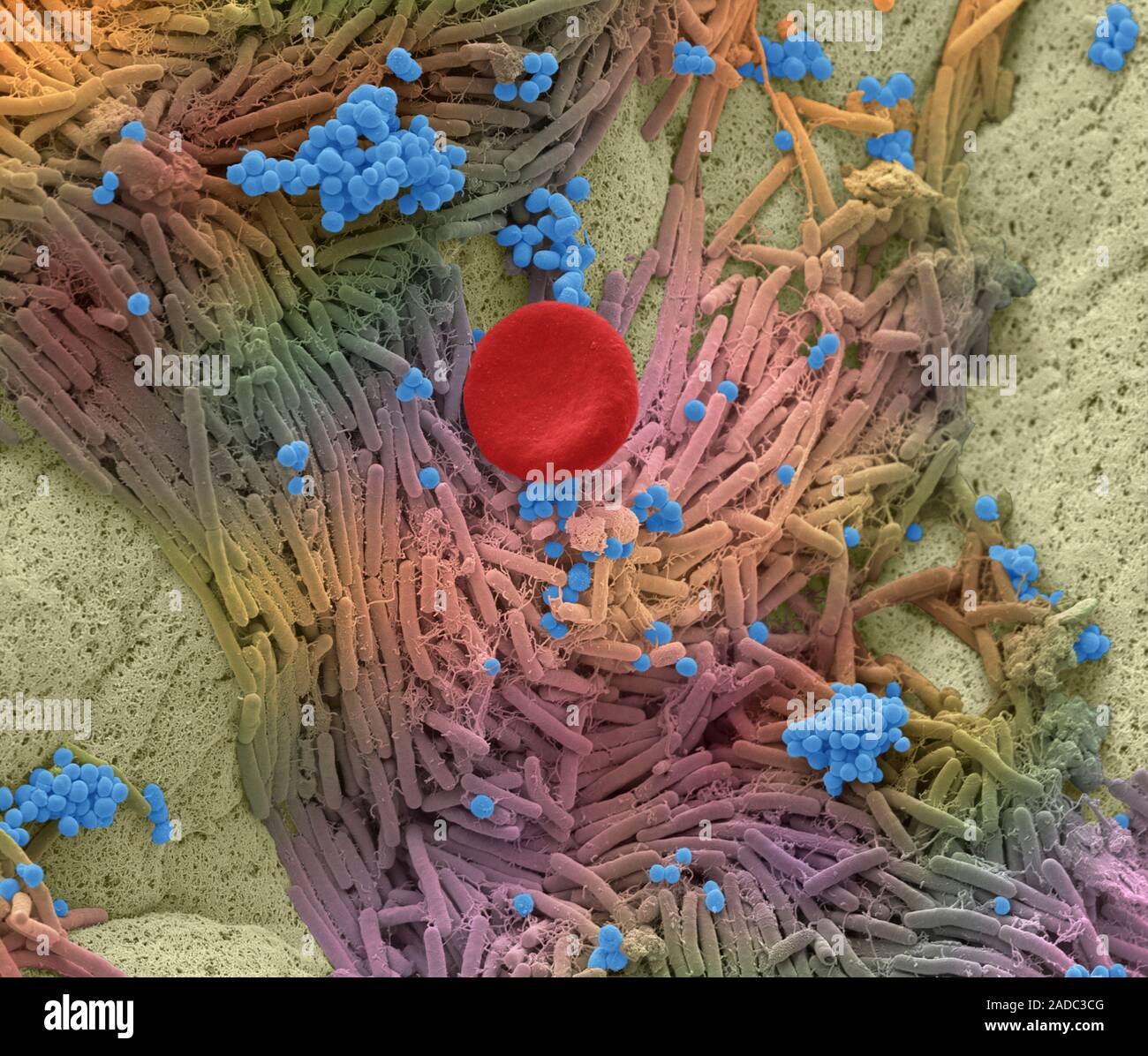 Microbiome. Coloured scanning electron micrograph (SEM) of bacteria ...