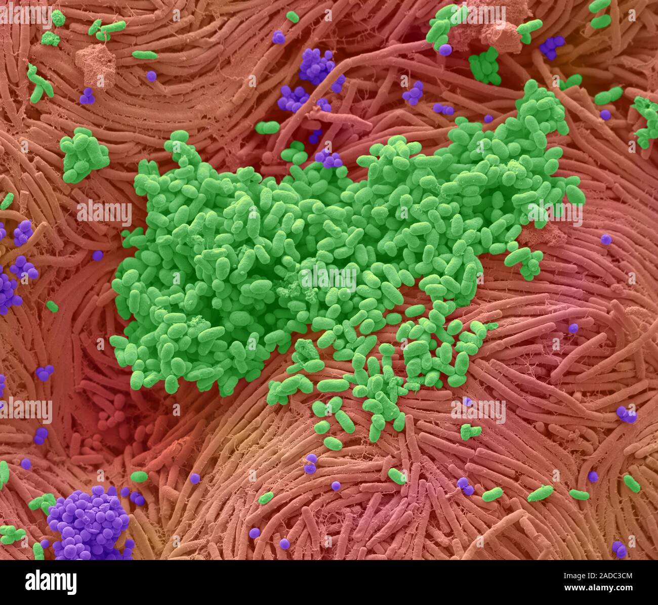 Coloured scanning electron micrograph (SEM) of bacteria cultured from a ...