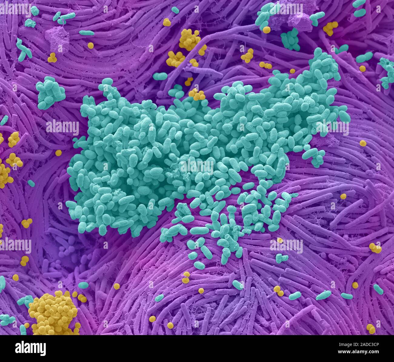 Coloured scanning electron micrograph (SEM) of bacteria cultured from a ...