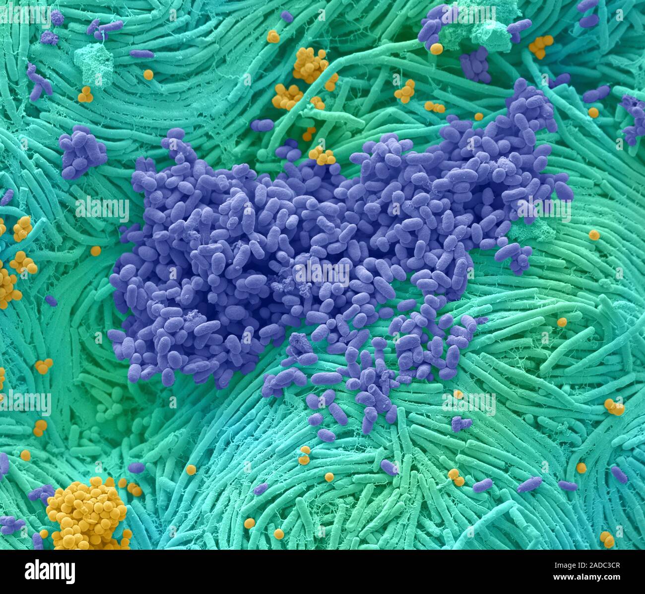 Coloured scanning electron micrograph (SEM) of bacteria cultured from a ...