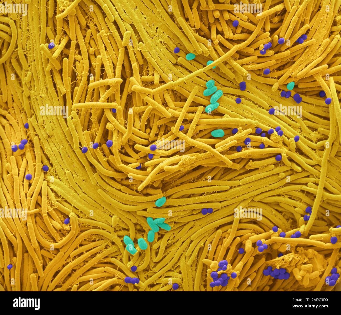 Nasal bacterial culture. Coloured scanning electron micrograph (SEM) of ...