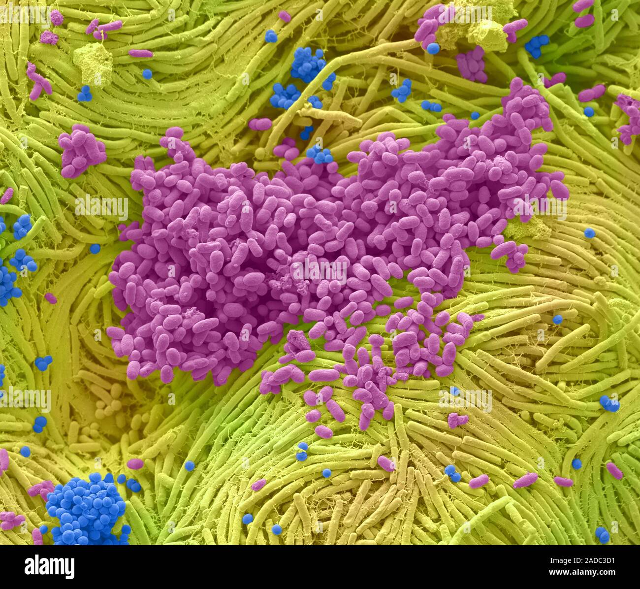 Coloured scanning electron micrograph (SEM) of bacteria cultured from a ...
