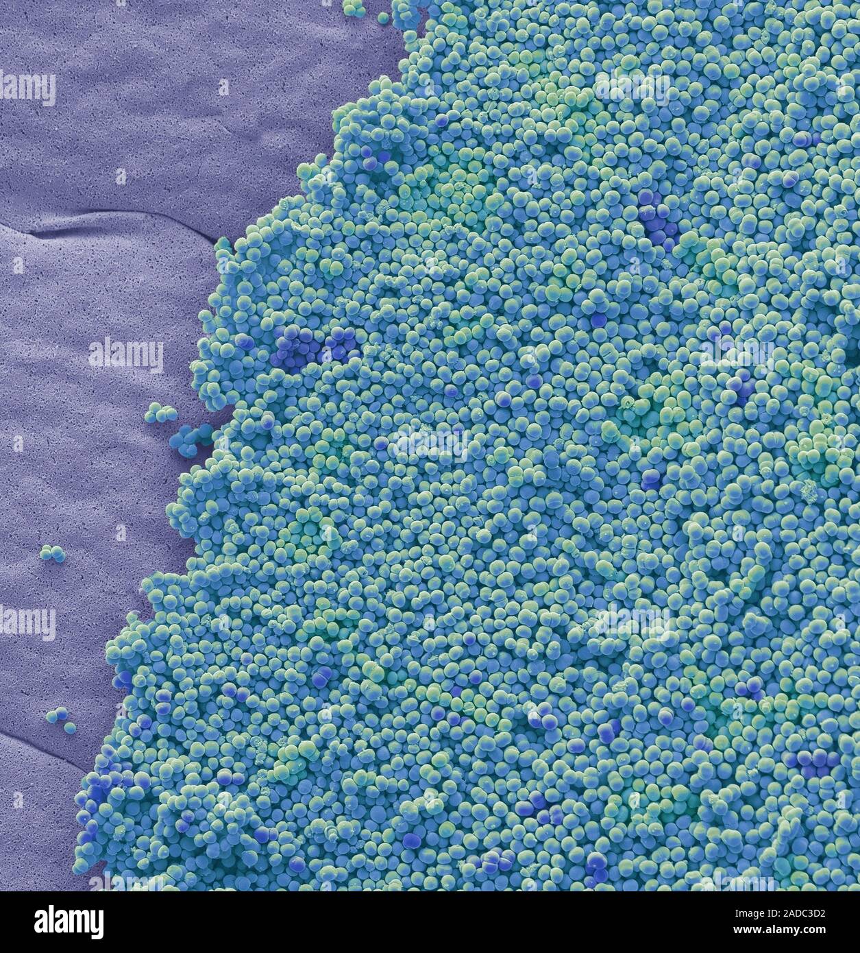 Nasal bacterial culture. Coloured scanning electron micrograph (SEM) of ... Nasal bacterial culture. Coloured scanning electron micrograph (SEM) of ...