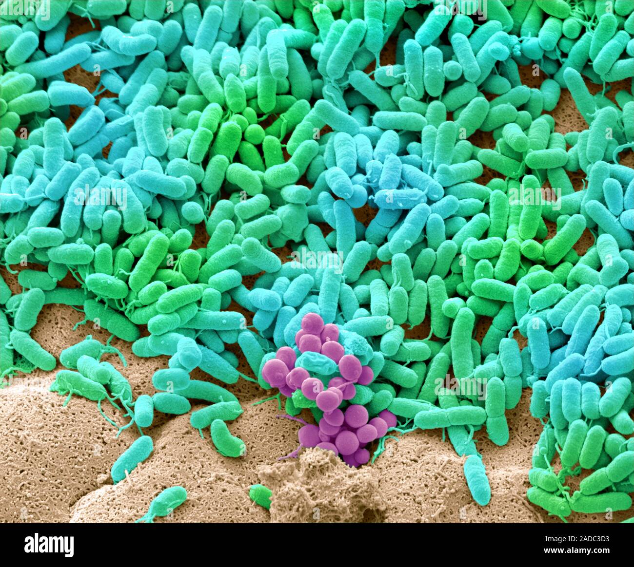 Coloured scanning electron micrograph (SEM) of bacteria cultured from a ...