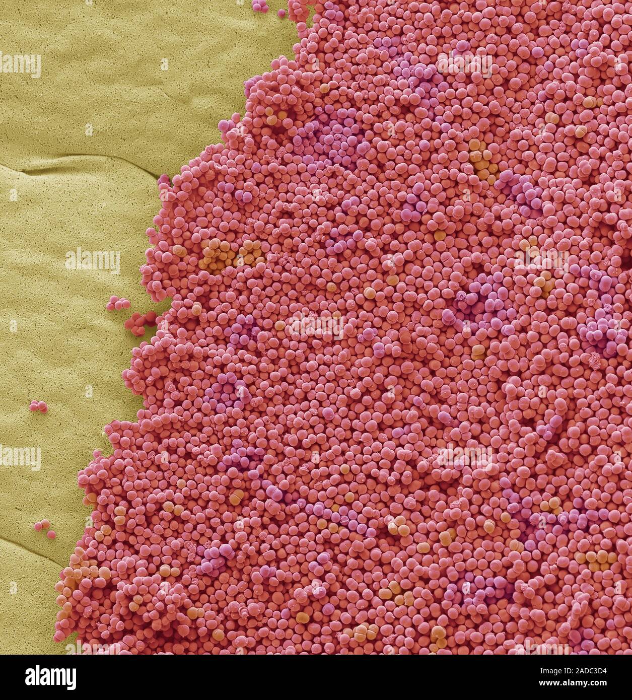 Nasal bacterial culture. Coloured scanning electron micrograph (SEM) of ... Nasal bacterial culture. Coloured scanning electron micrograph (SEM) of ...