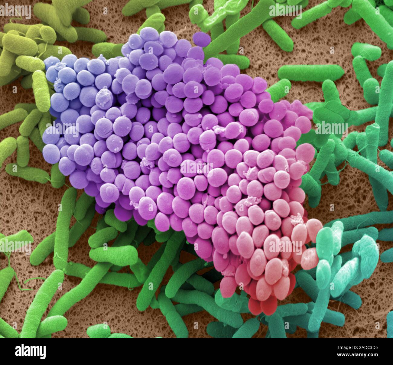 Coloured scanning electron micrograph (SEM) of bacteria cultured from a ...