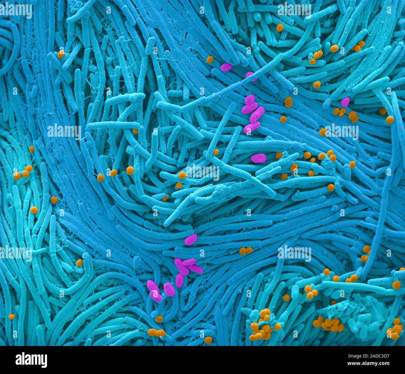 Nasal bacterial culture. Coloured scanning electron micrograph (SEM) of ... Nasal bacterial culture. Coloured scanning electron micrograph (SEM) of ...