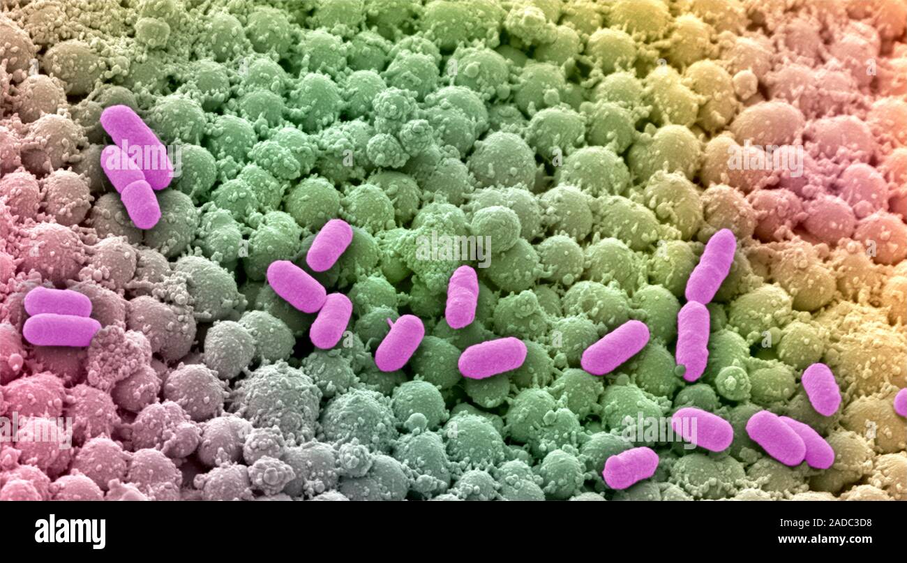 Nasal bacterial culture. Coloured scanning electron micrograph (SEM) of ... Nasal bacterial culture. Coloured scanning electron micrograph (SEM) of ...