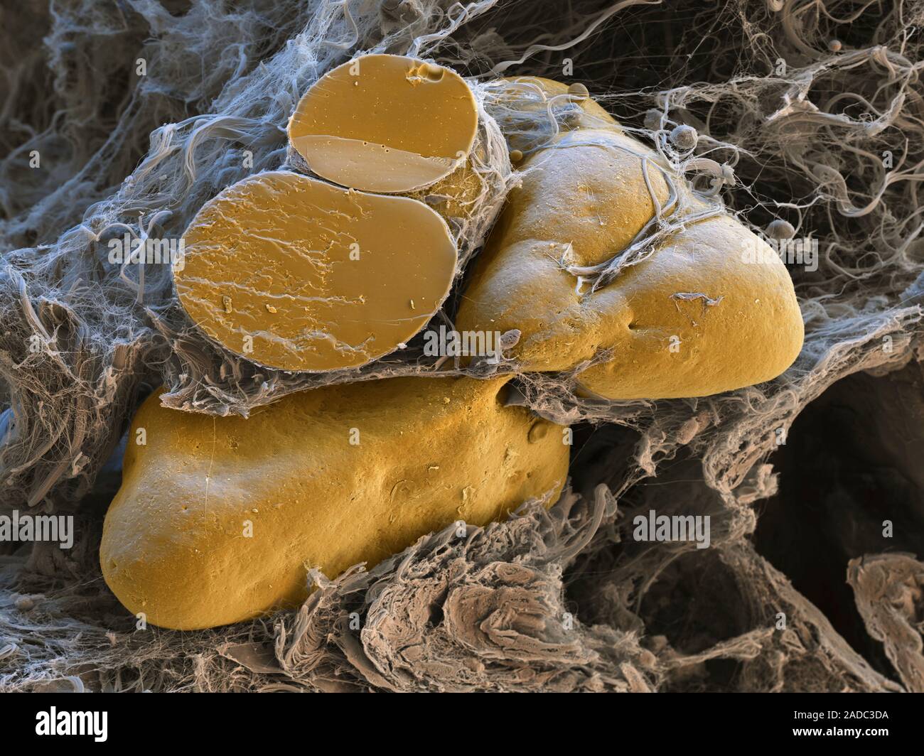 Fat cells. Coloured scanning electron micrograph (SEM) of a freeze ...